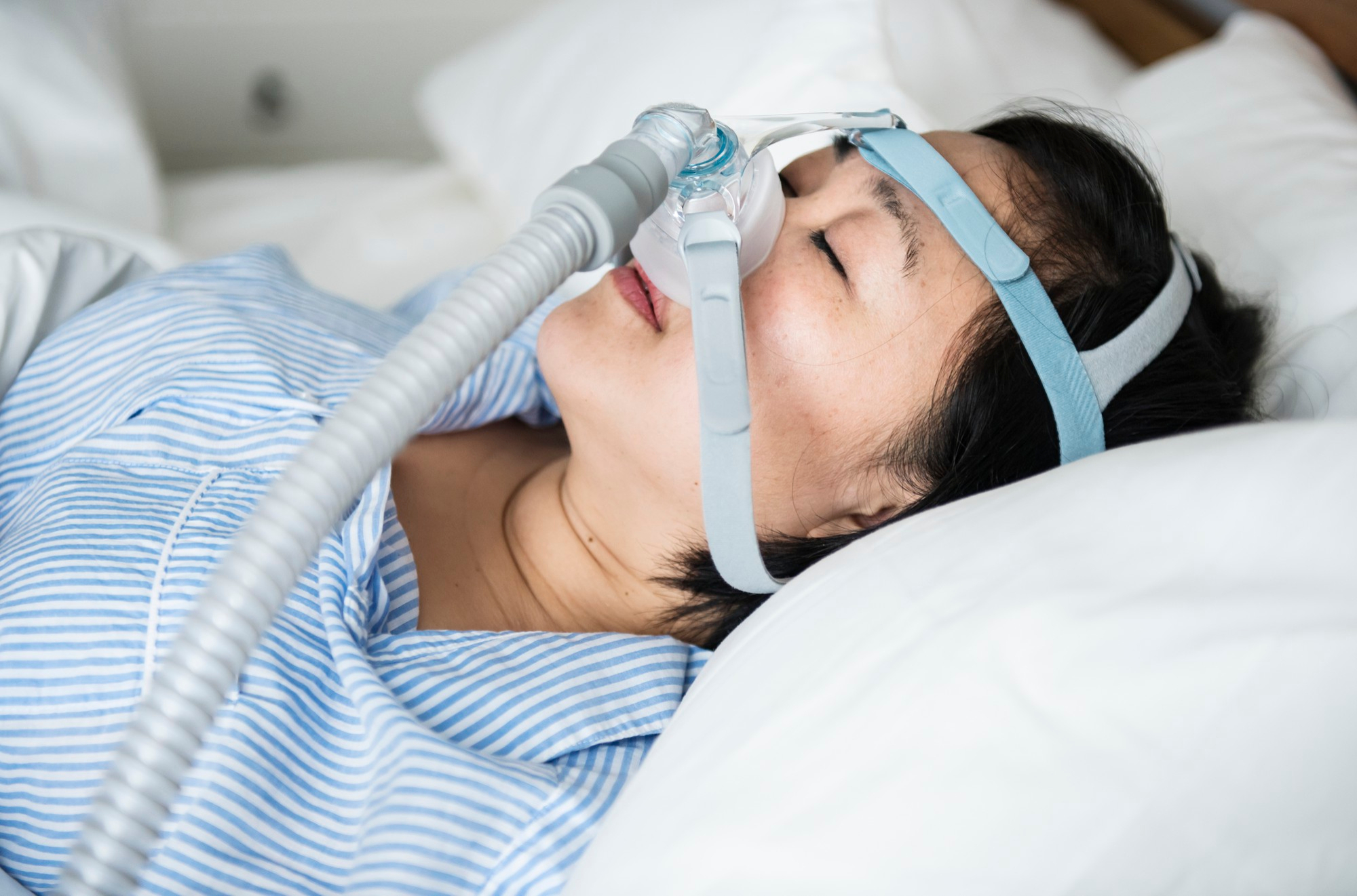 Les traitements de l’apnée du sommeil : du mode de vie à la ventilation ...